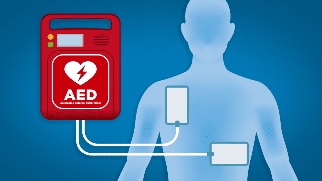 Automated External Defibrillators AED BAFCA Automated External Defibrillators AED BAFCA